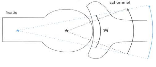 Convex Concave Rule – Explained! | JC Physiotherapy