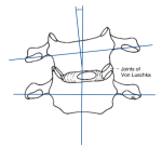 Joints of Luschka | JC Physiotherapy