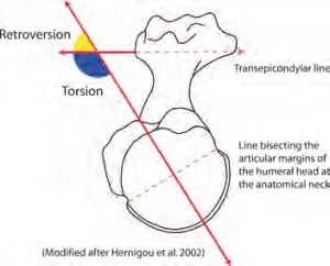 Evaluation – Sub Acromial Pain Syndrome (SAPS) | JC Physiotherapy
