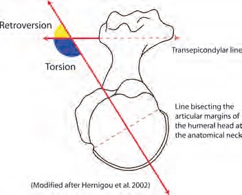 Evaluation – Sub Acromial Pain Syndrome (SAPS) | JC Physiotherapy