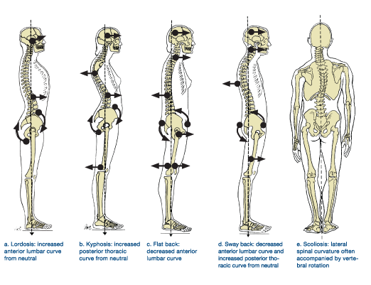 Postural Analysis | JC Physiotherapy